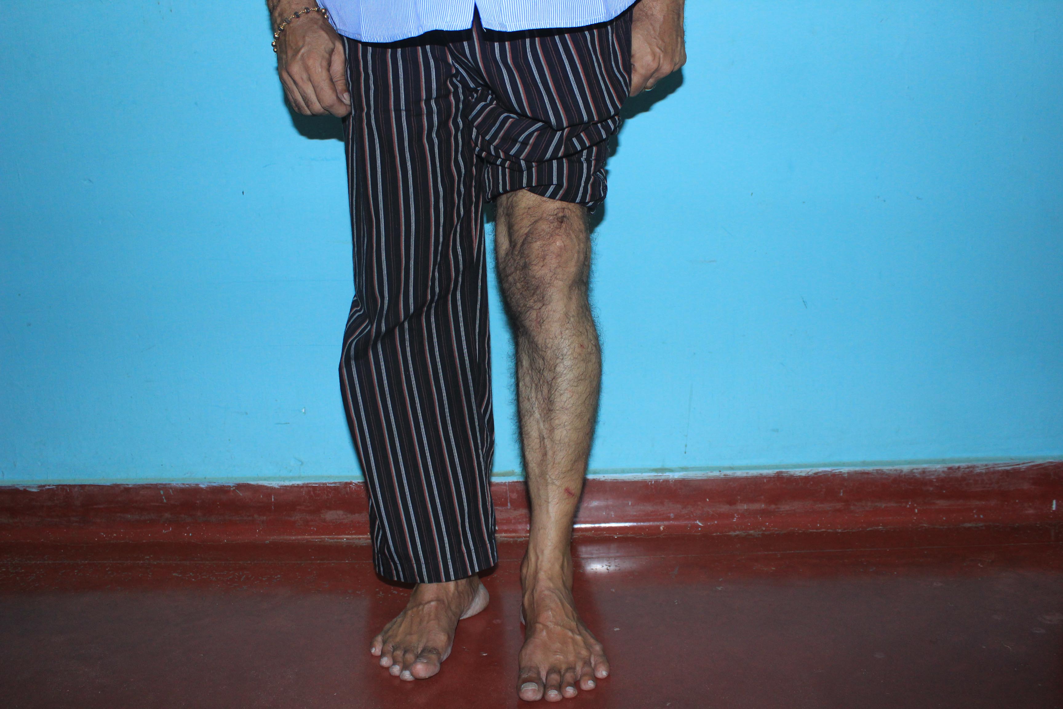 Patients Photo – Dr. PRAMOD MOHAN
