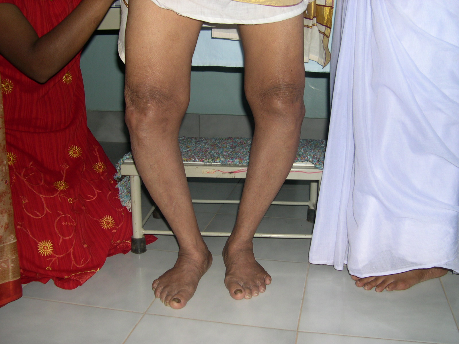 Patients Photo – Dr. PRAMOD MOHAN